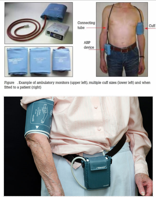 16. Ambulatory Blood Pressure (BP) Monitor - Dr. Osman Beton